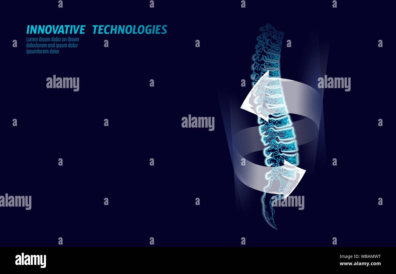 Human spine injury physiotherapy protection. Pain area surgery ...