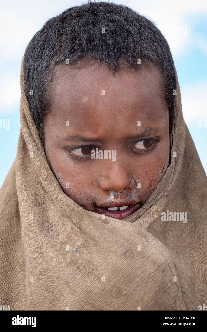 Poor children africa hi-res stock photography and images - Alamy