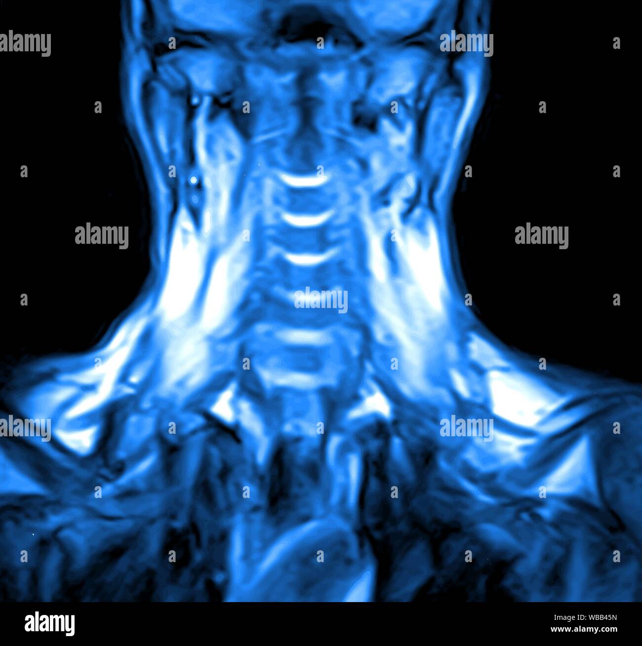 Human Skull And Cervical Spine High Resolution Stock Photography and ...