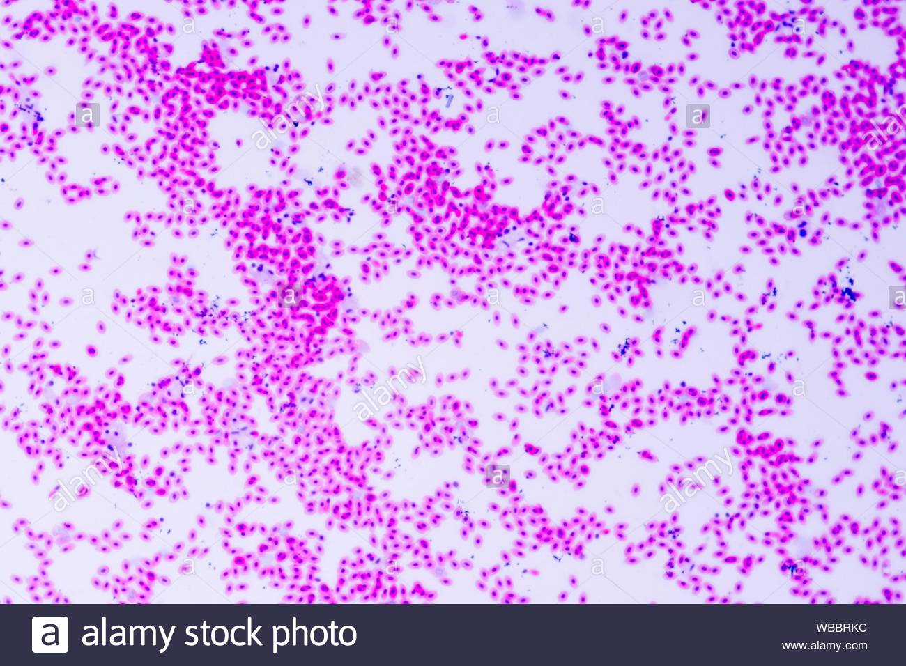 Micrograph Blood Stock Photos & Micrograph Blood Stock Images - Alamy