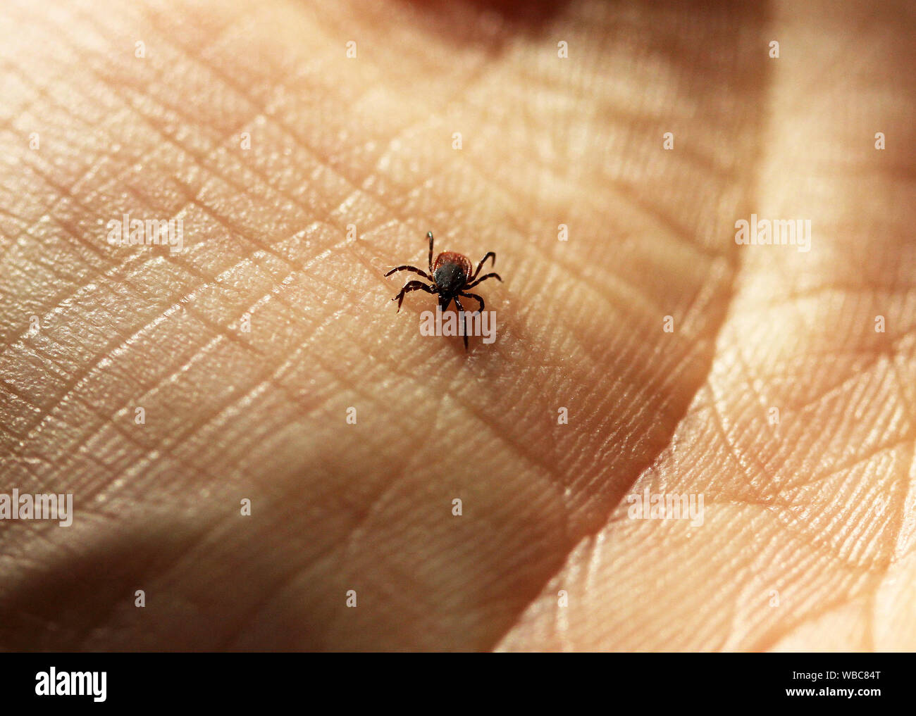 Tick crawling on skin Stock Photo - Alamy