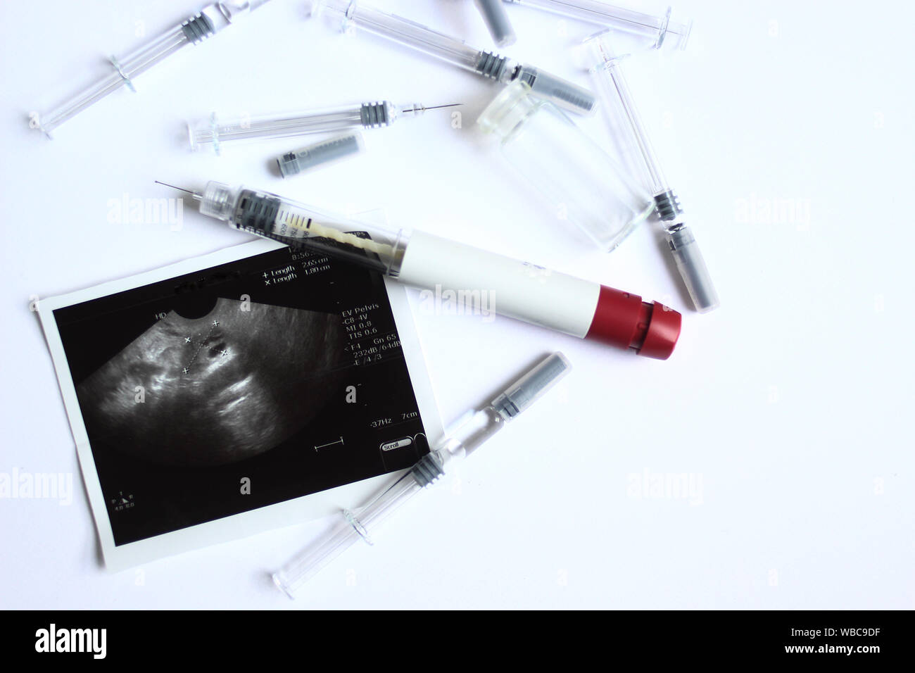 Fertility factor hi-res stock photography and images - Alamy