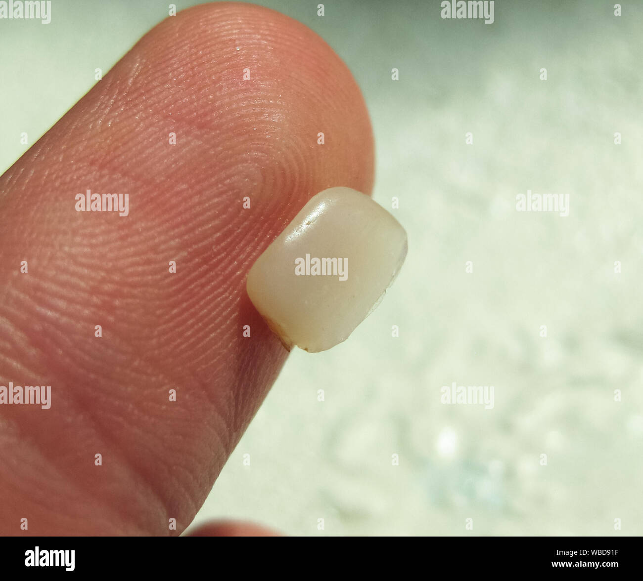 Fallen off old filling with a cutter. The seal of the tooth Stock Photo ...