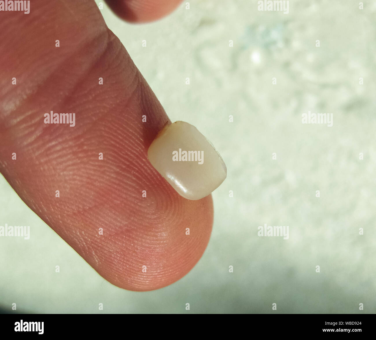 Photopolymer filling hi-res stock photography and images - Alamy