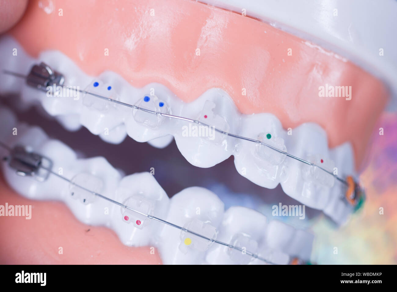 Modern metal retainers and plastic algners wire dental brackets teeth ...