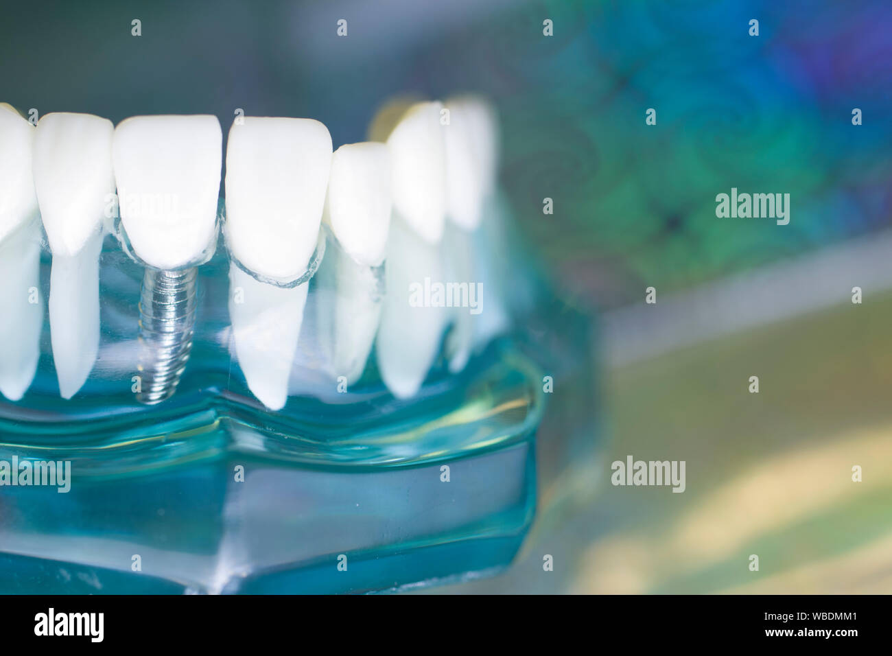 Dentists perfect white teeth teaching dental plastic model with ...