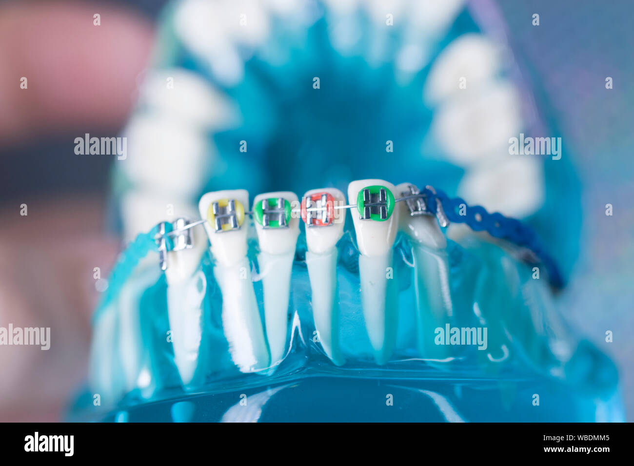 Modern metal retainers and plastic algners wire dental brackets teeth ...