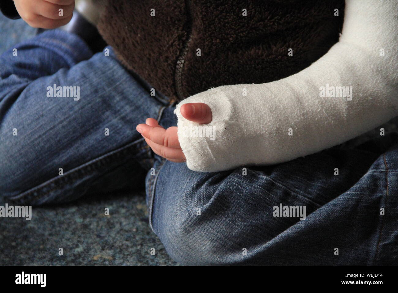 Cast broken hand thumb hi-res stock photography and images - Alamy