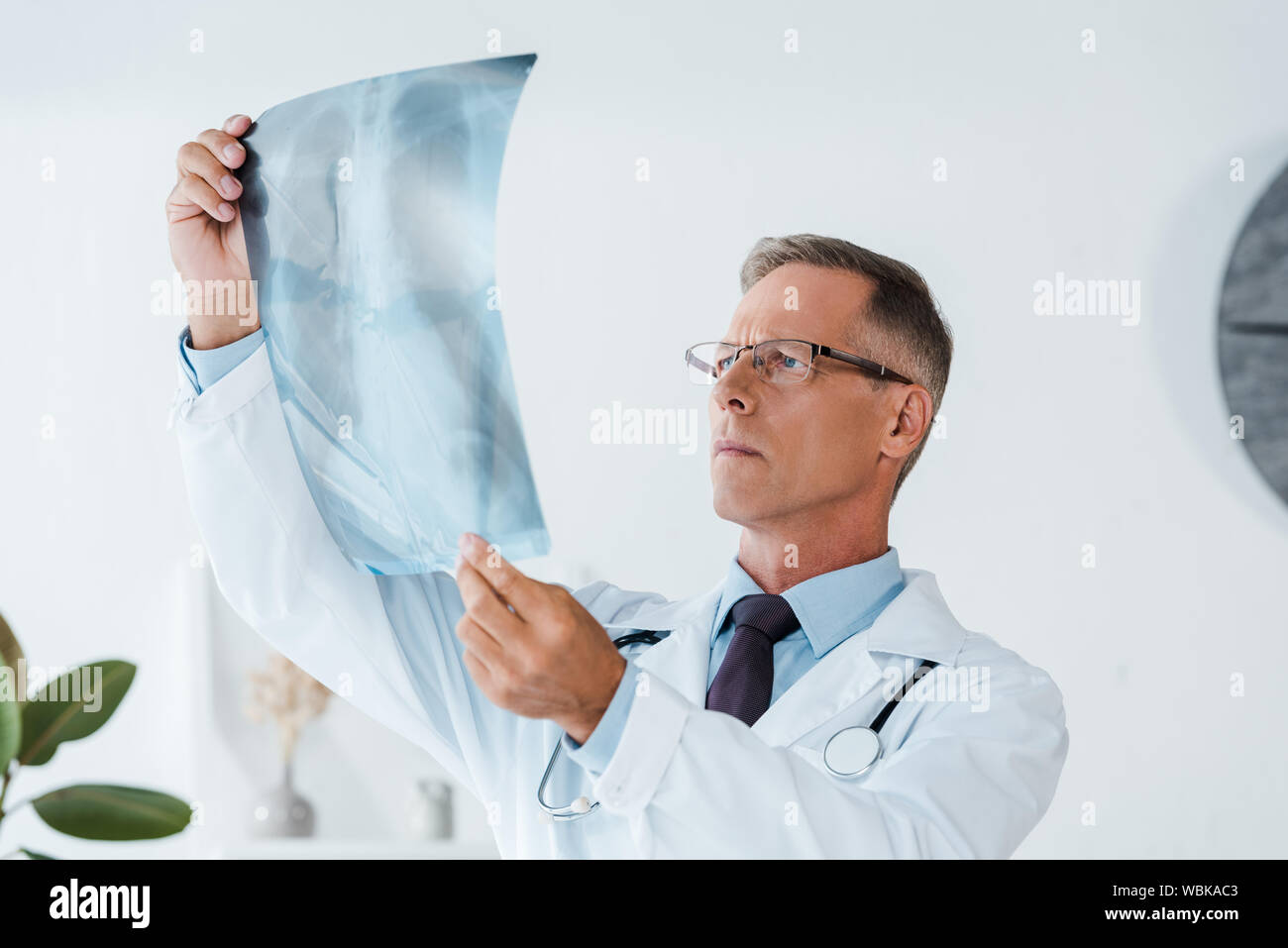 serious doctor in white coat and glasses holding x-ray in hospital ...