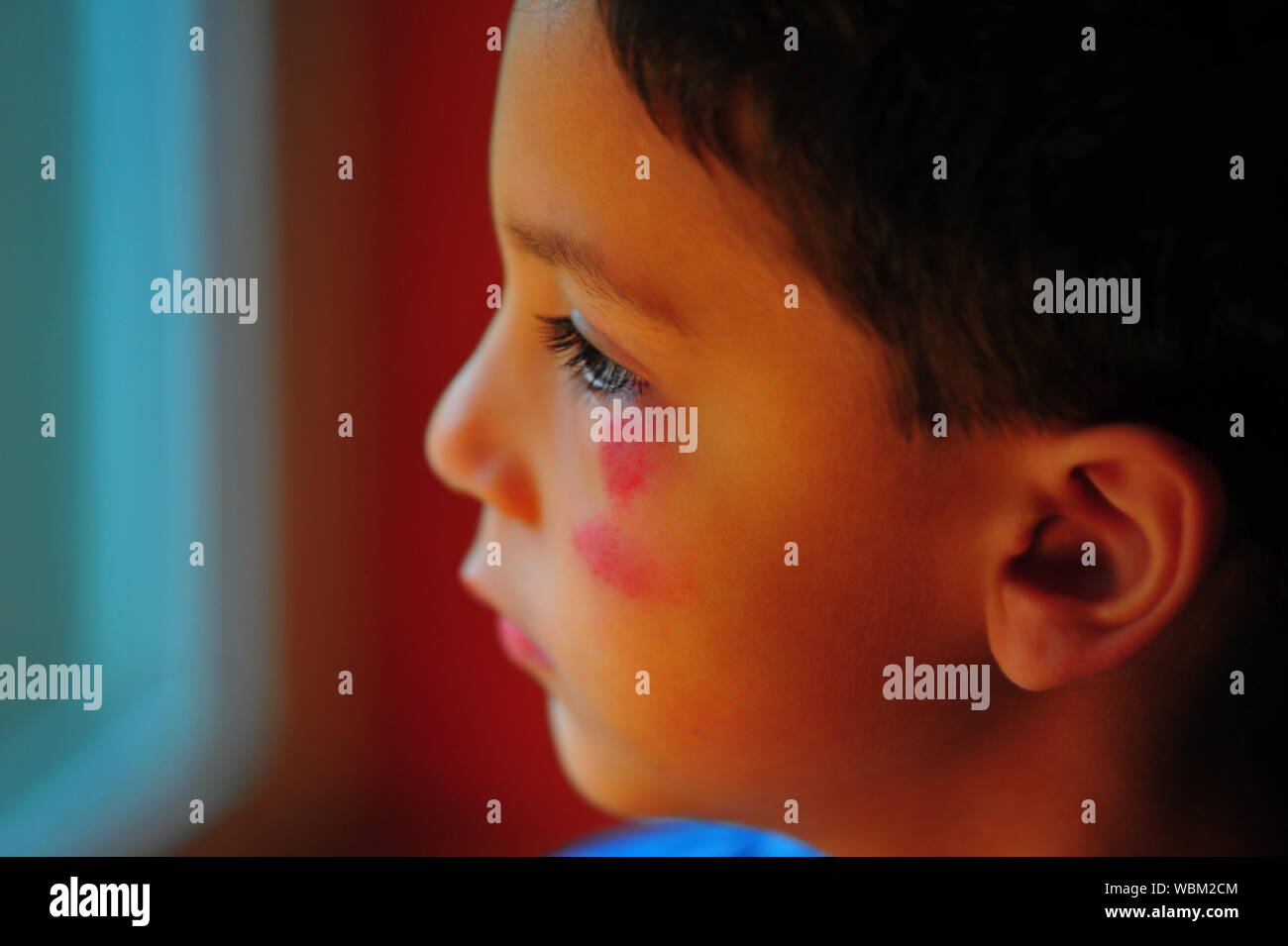 Scar on face hi-res stock photography and images - Alamy