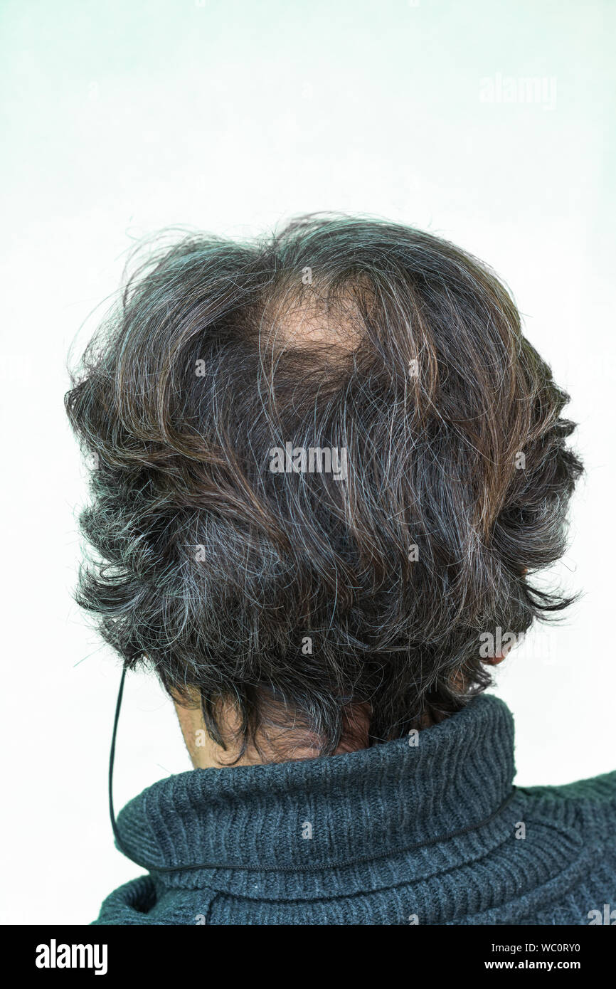 Balding men hi-res stock photography and images - Alamy
