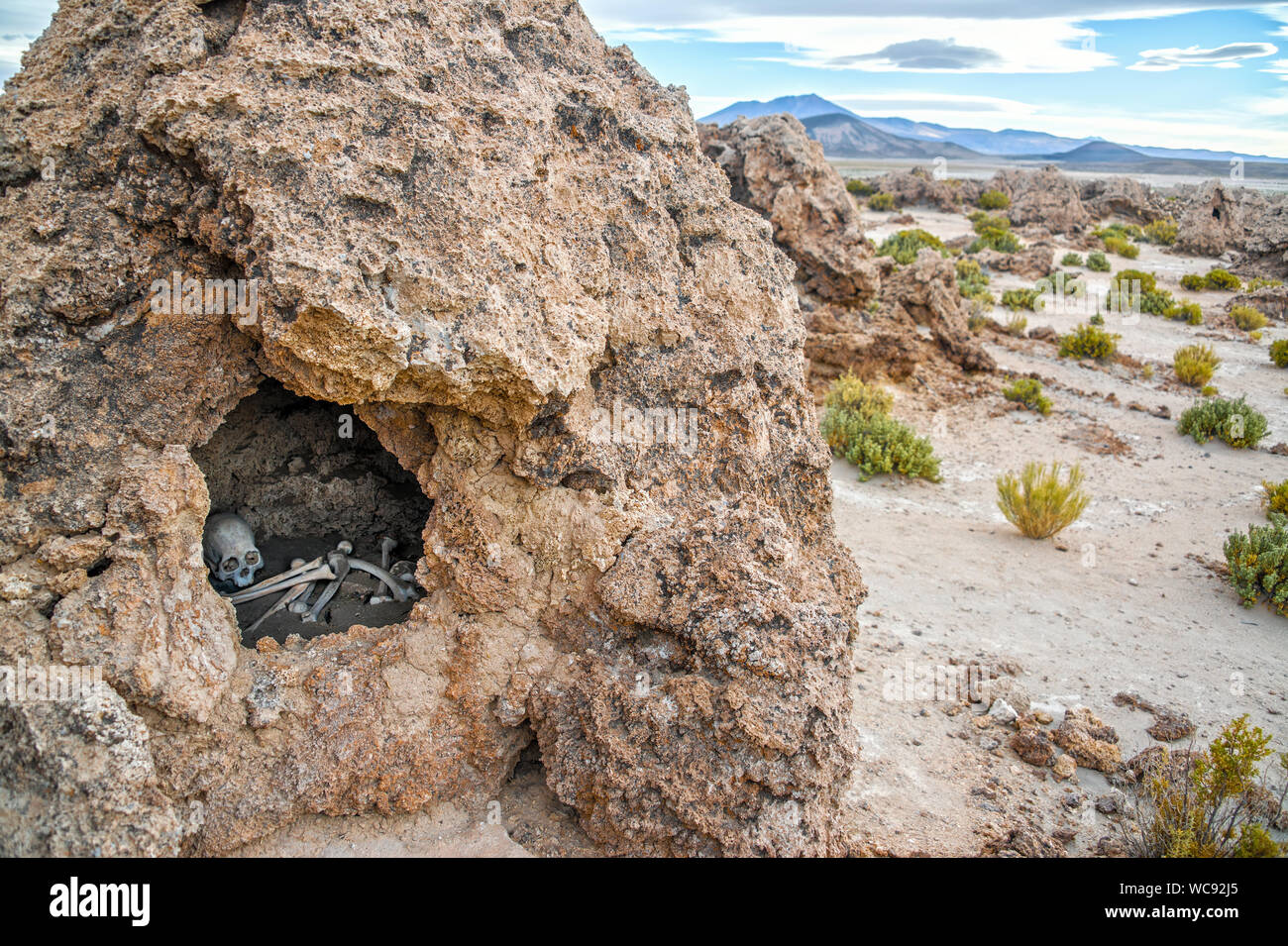 Bone Formation High Resolution Stock Photography and Images - Alamy