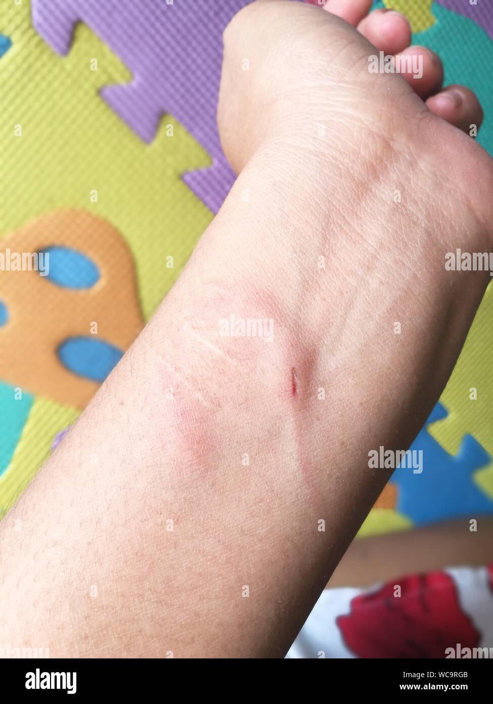 Hand wound hi-res stock photography and images - Alamy