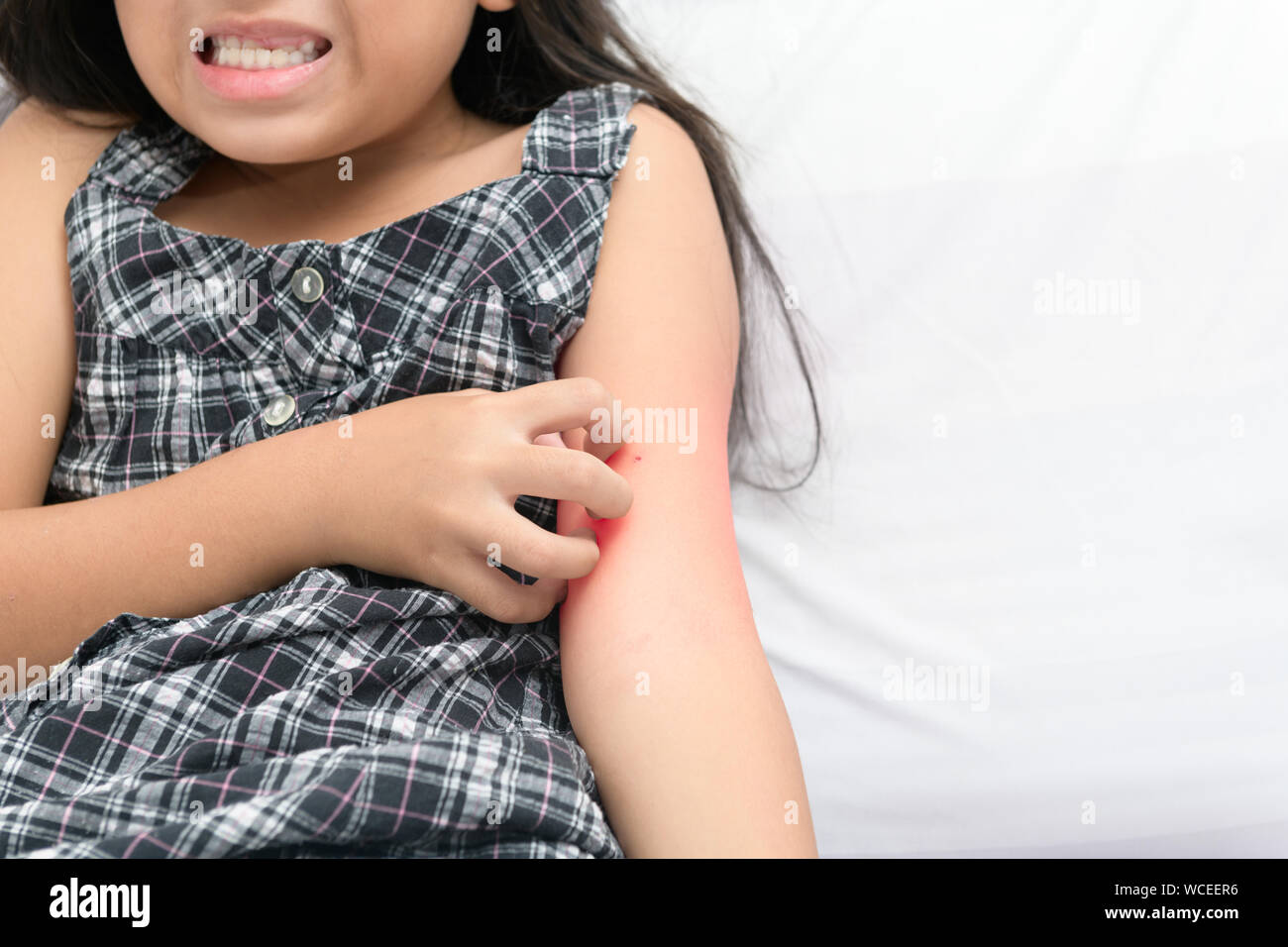 girl scratch the itch with hand , Concept with Healthcare And Medicine ...