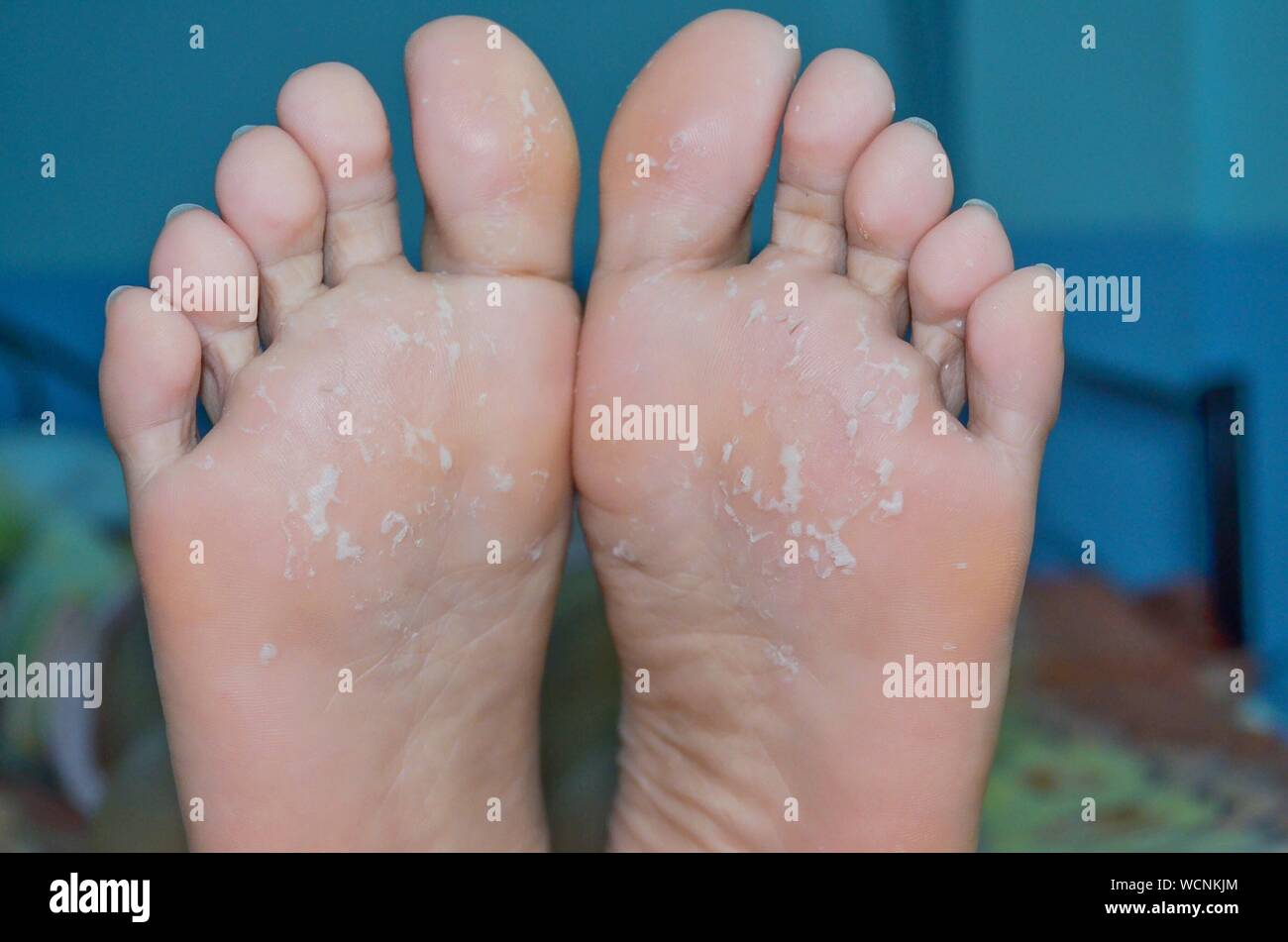 Barefeet barefoot leg hi-res stock photography and images - Alamy