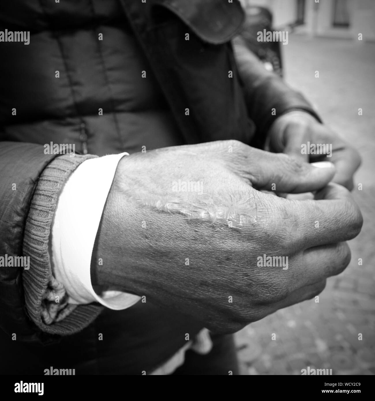Hand Scar High Resolution Stock Photography and Images - Alamy