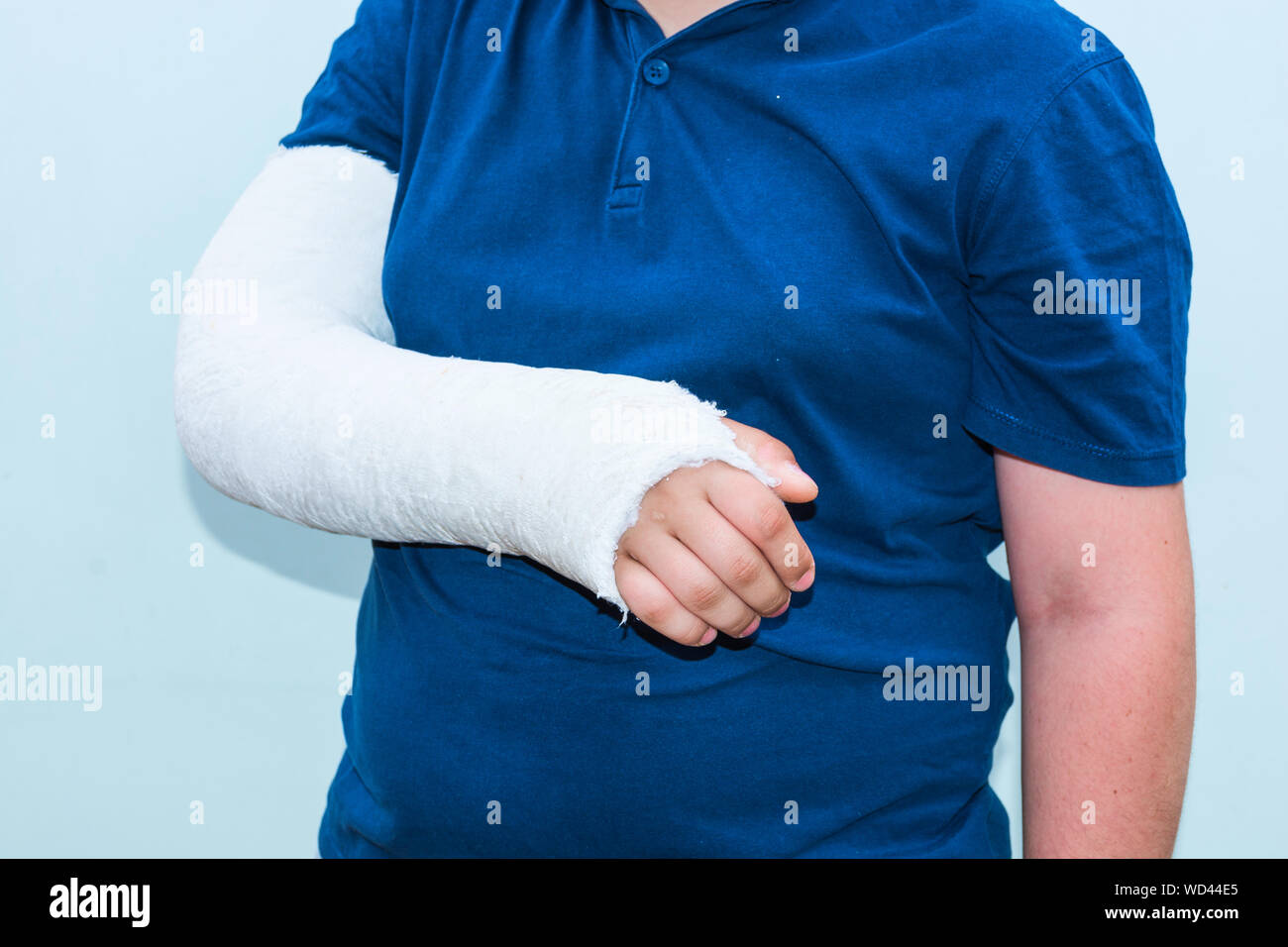 Fractured person hi-res stock photography and images - Alamy