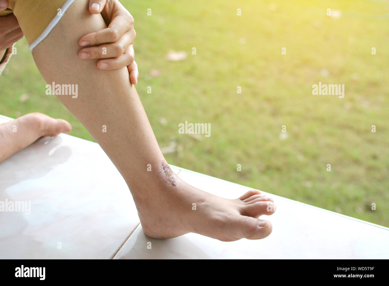 Injured woman hi-res stock photography and images - Alamy