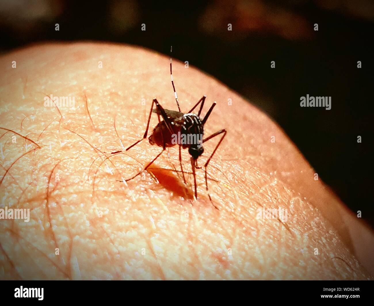 Mosquito biting skin close up hi-res stock photography and images - Alamy