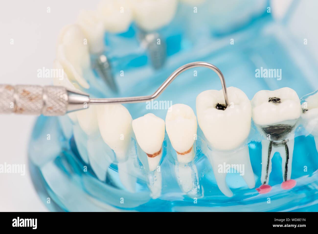 Prosthetic hook hi-res stock photography and images - Alamy