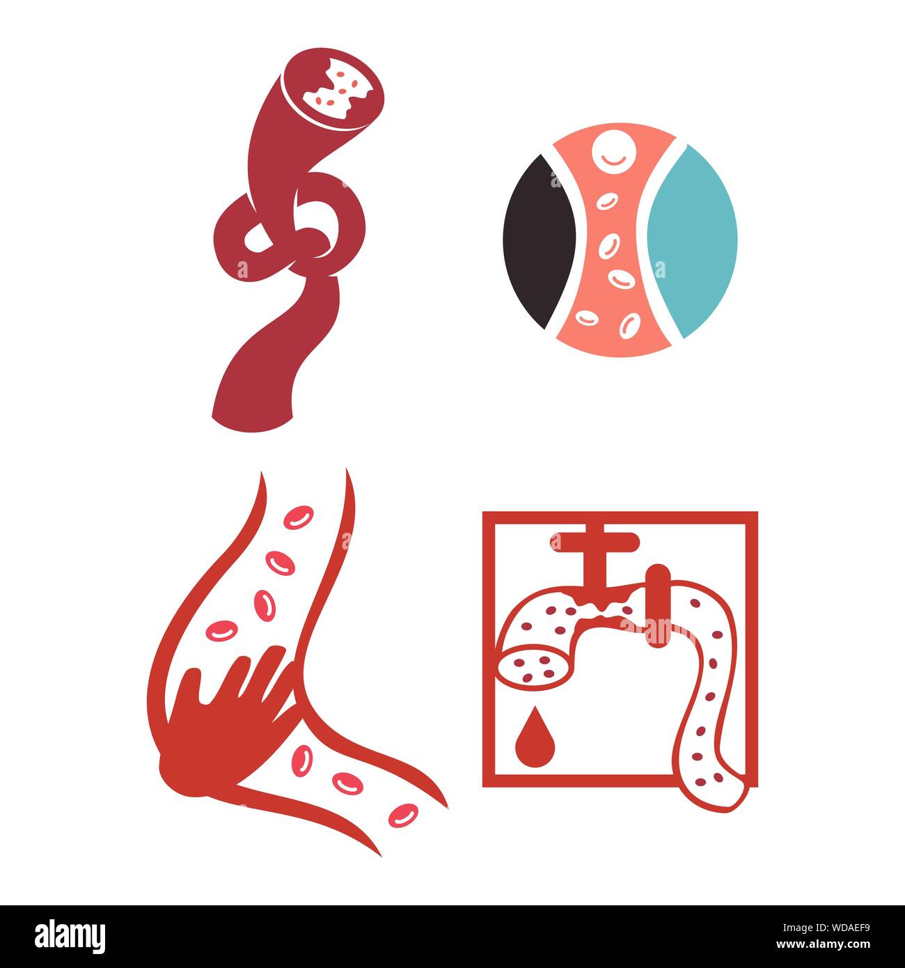 Cholesterol in artery health risk vector design Illustration Stock ...