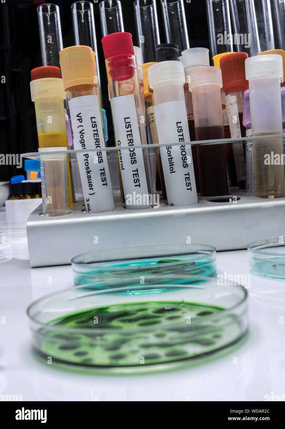 Listeria monocytogenes petri hi-res stock photography and images - Alamy