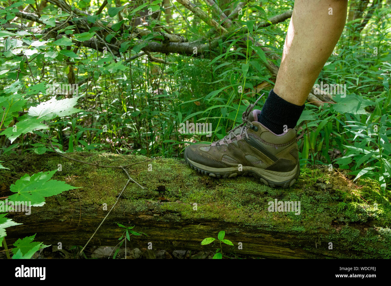 Traction leg hi-res stock photography and images - Alamy