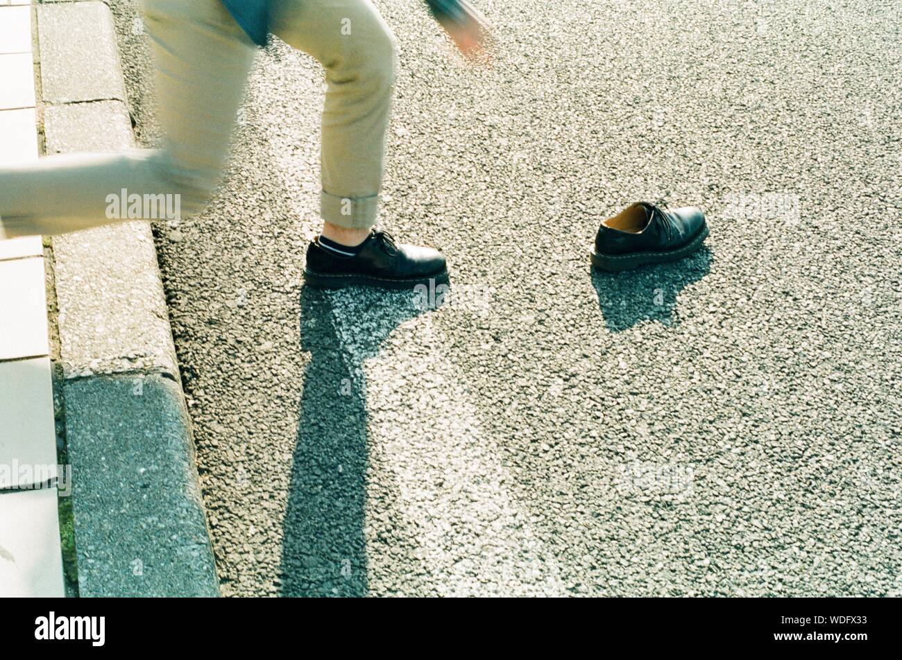 Lost leg hi-res stock photography and images - Alamy