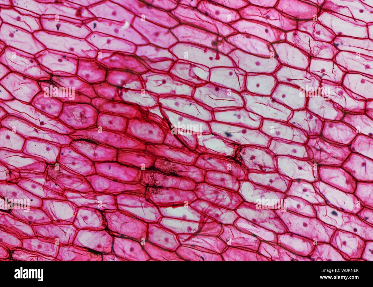 Giant cell hi-res stock photography and images - Alamy