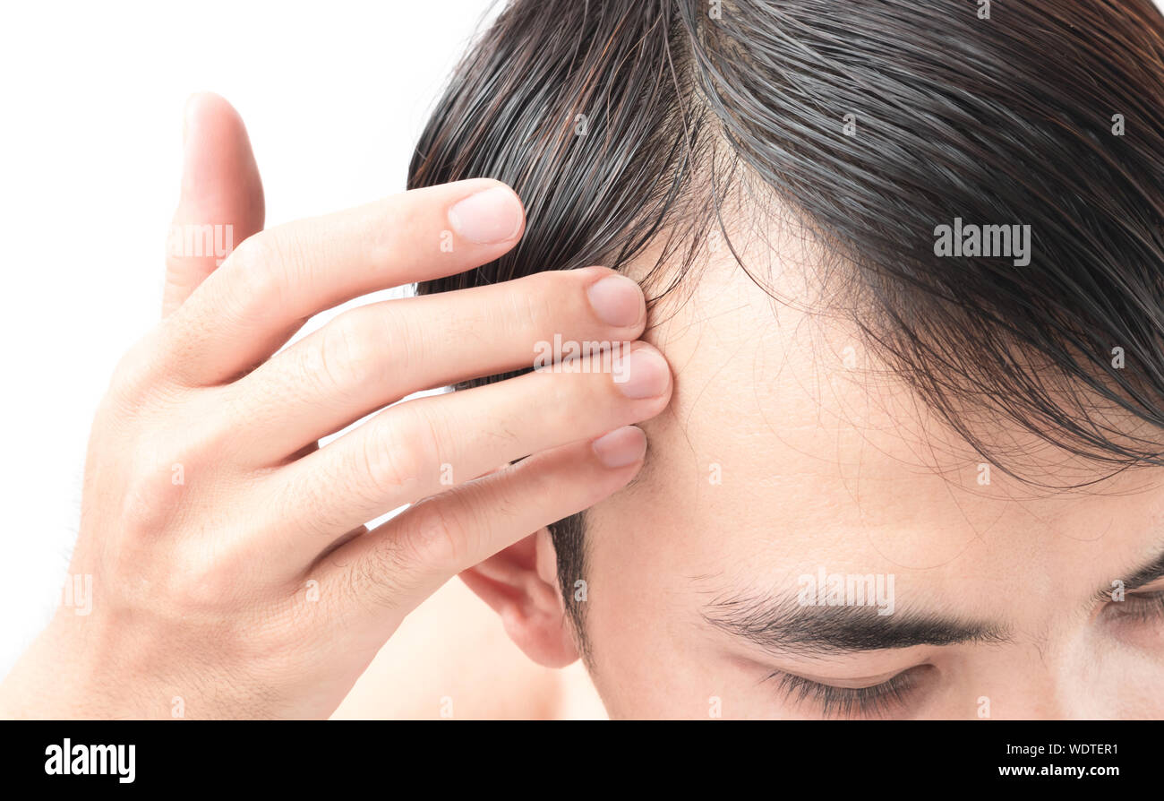 Receding hair hi-res stock photography and images - Alamy