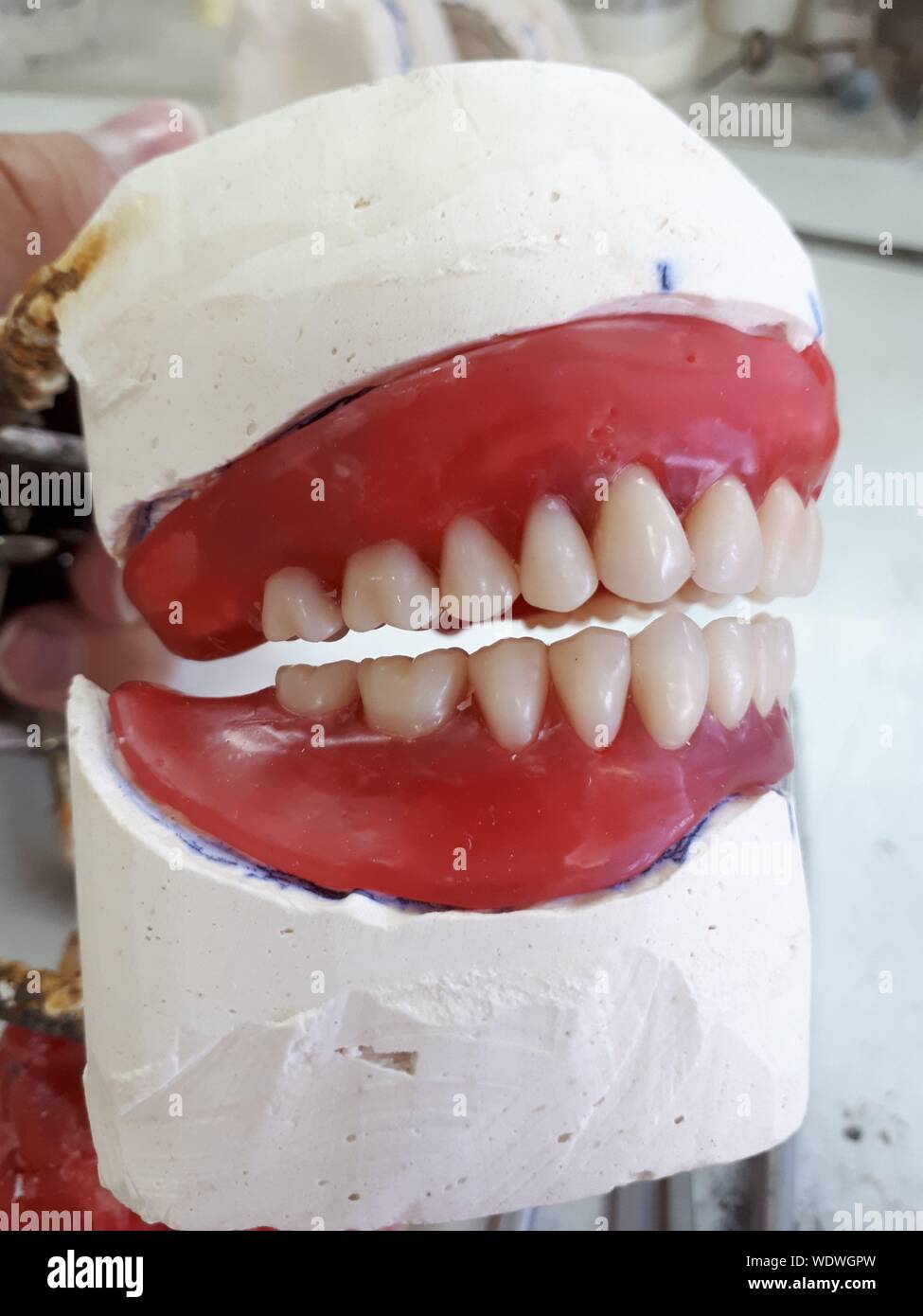 Teeth model hi-res stock photography and images - Alamy