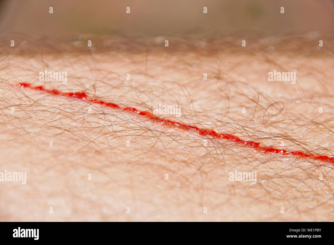 Blood shot hi-res stock photography and images - Alamy