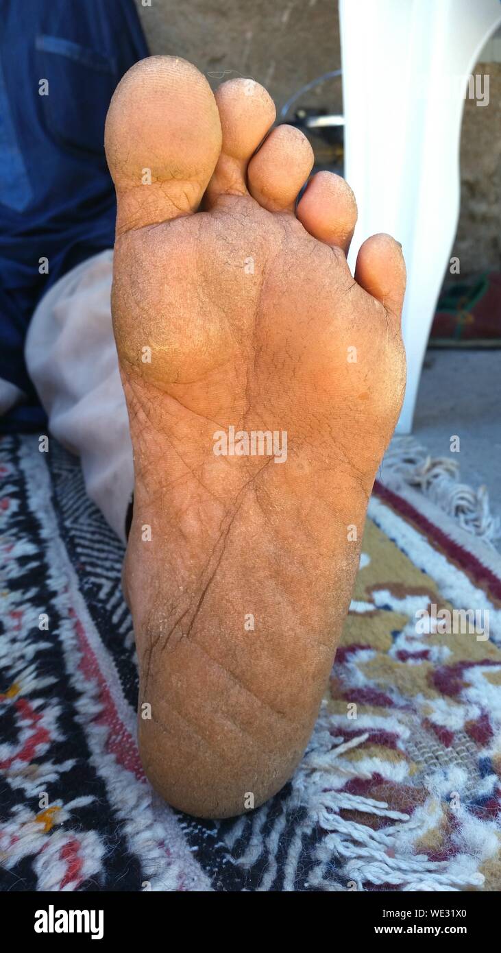 Barefoot sole hi-res stock photography and images - Alamy