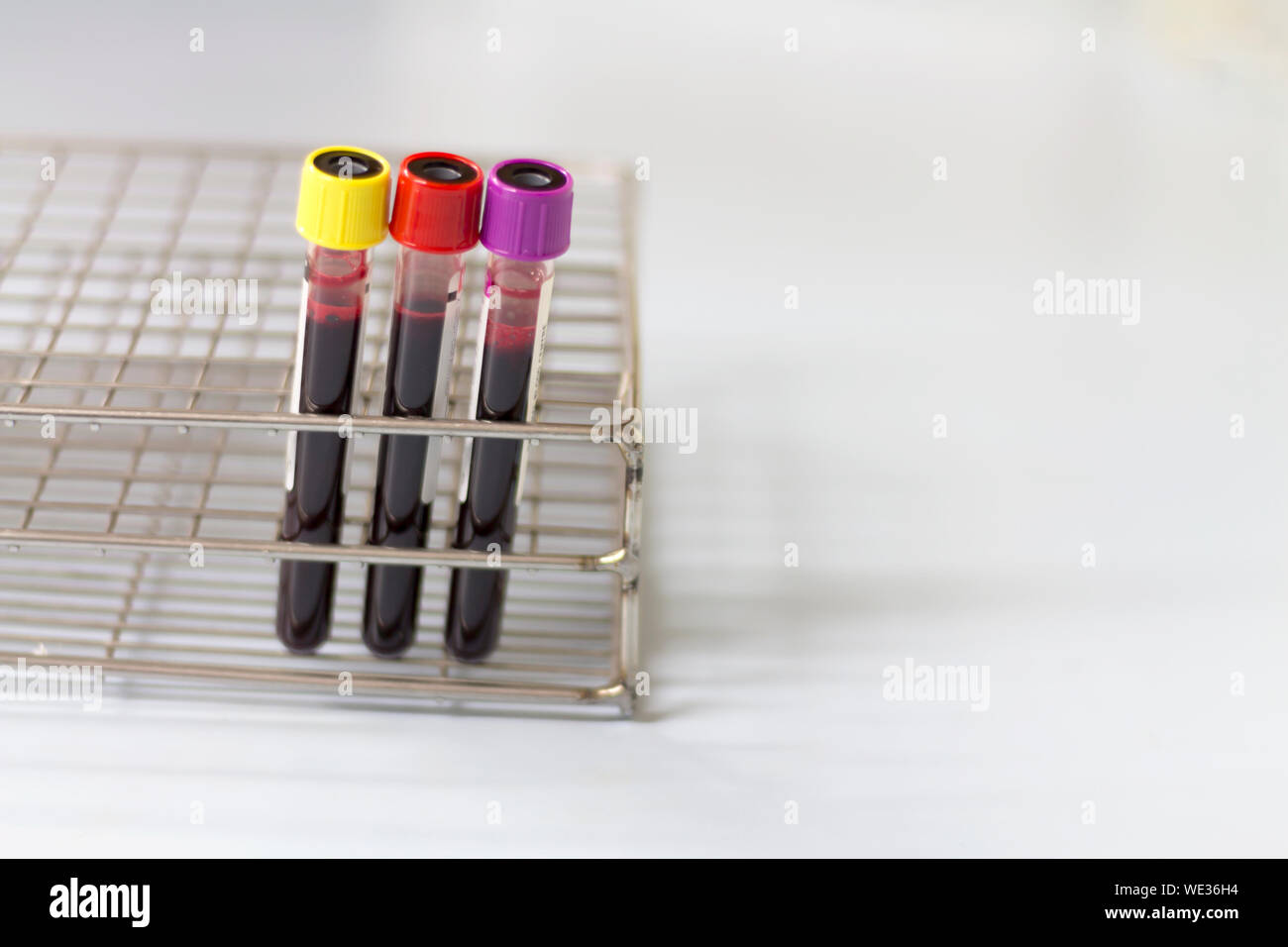 Test tube in rack sample hi-res stock photography and images - Alamy