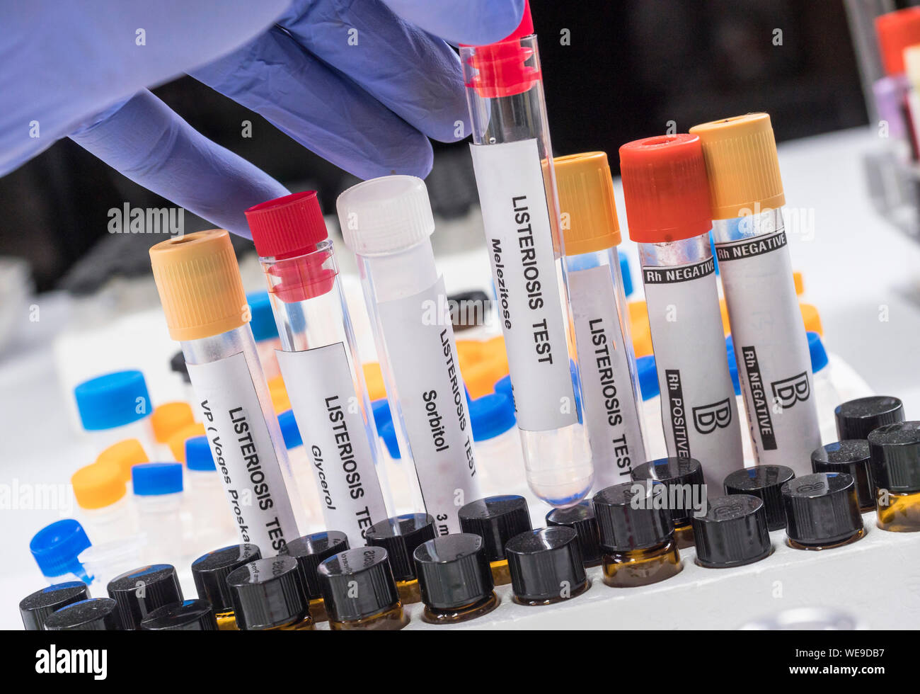 Listeria monocytogenes petri hi-res stock photography and images - Alamy