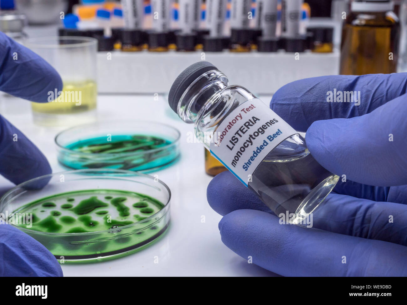 Listeria monocytogenes bacteria hi-res stock photography and images - Alamy