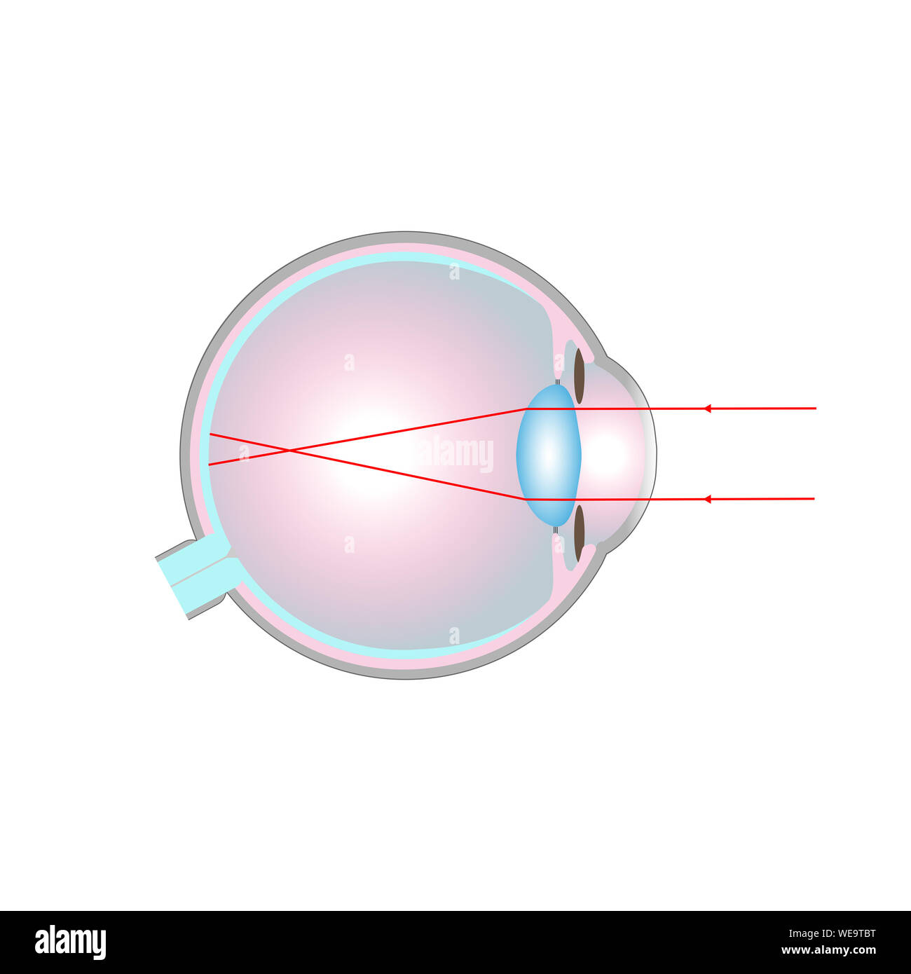 Short sightedness hi-res stock photography and images - Alamy