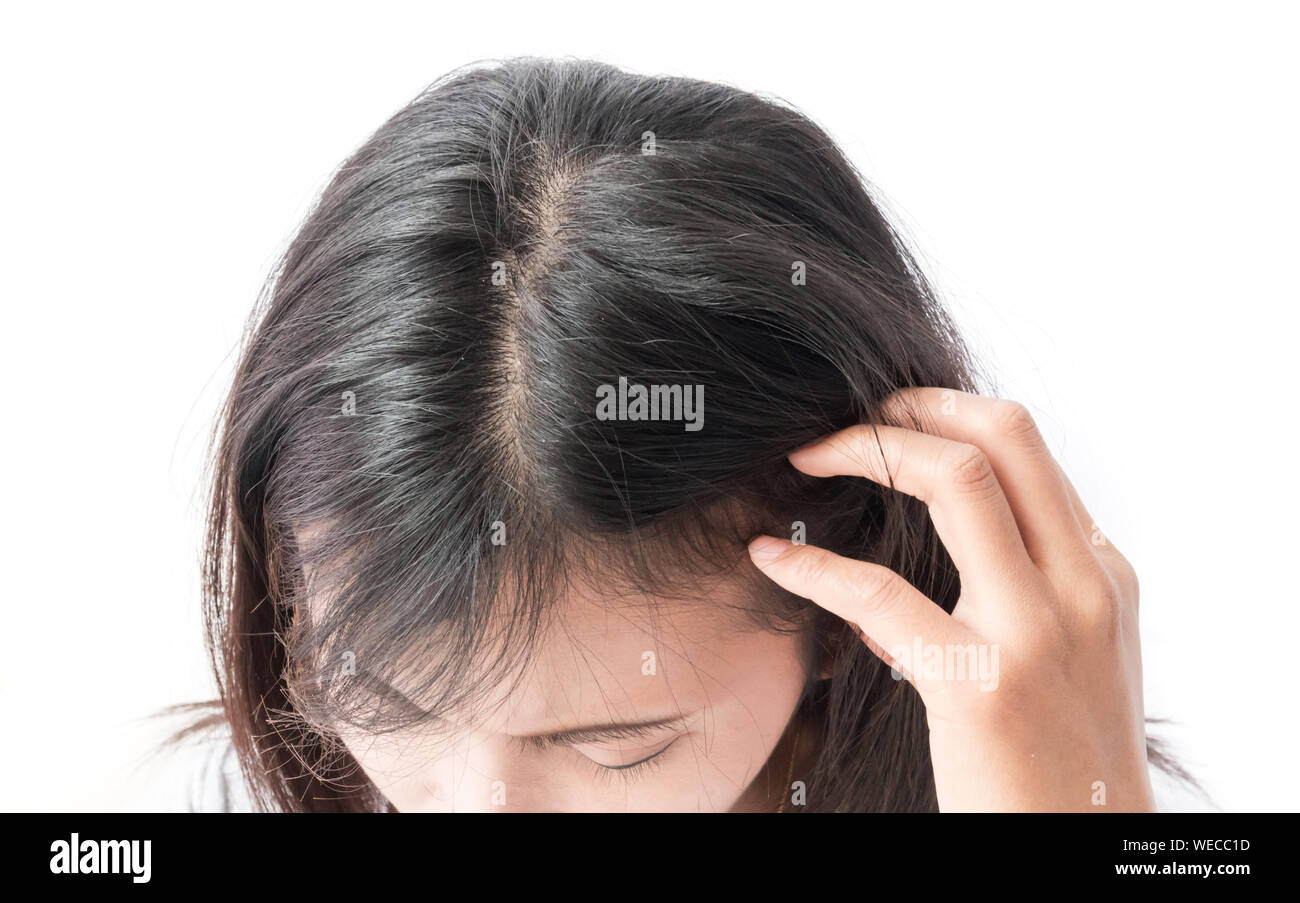 Woman Scratching Her Face High Resolution Stock Photography and Images ...