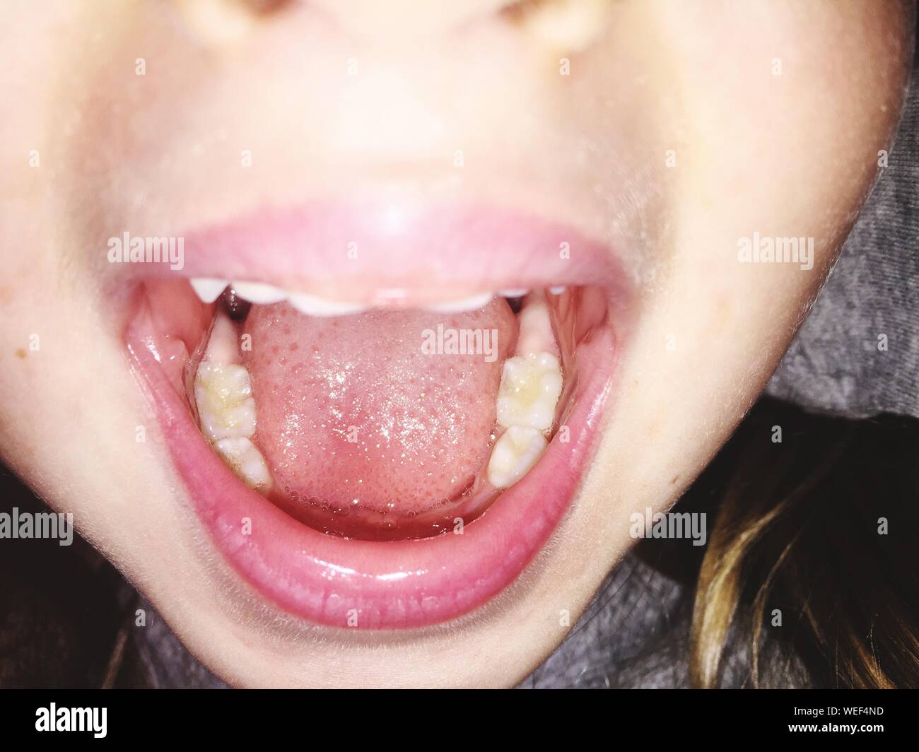Open mouth human teeth hi-res stock photography and images - Alamy