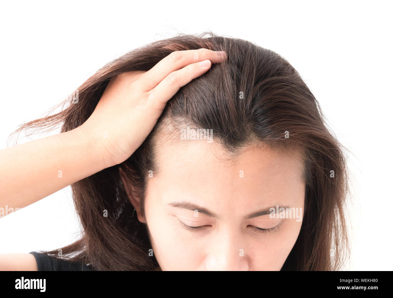 Woman loss hair hi-res stock photography and images - Alamy