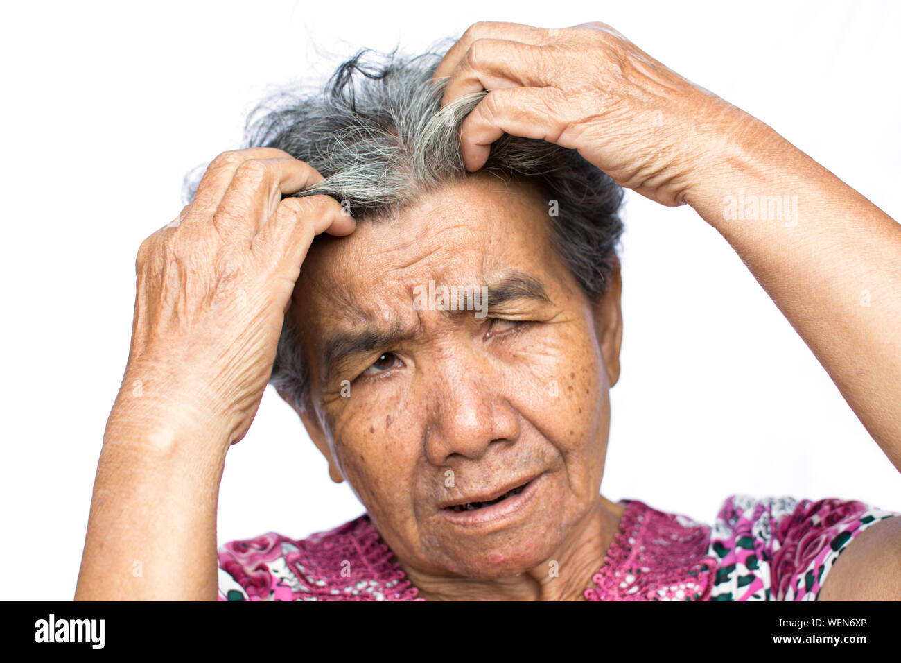 Woman scratching head not itch hi-res stock photography and images - Alamy