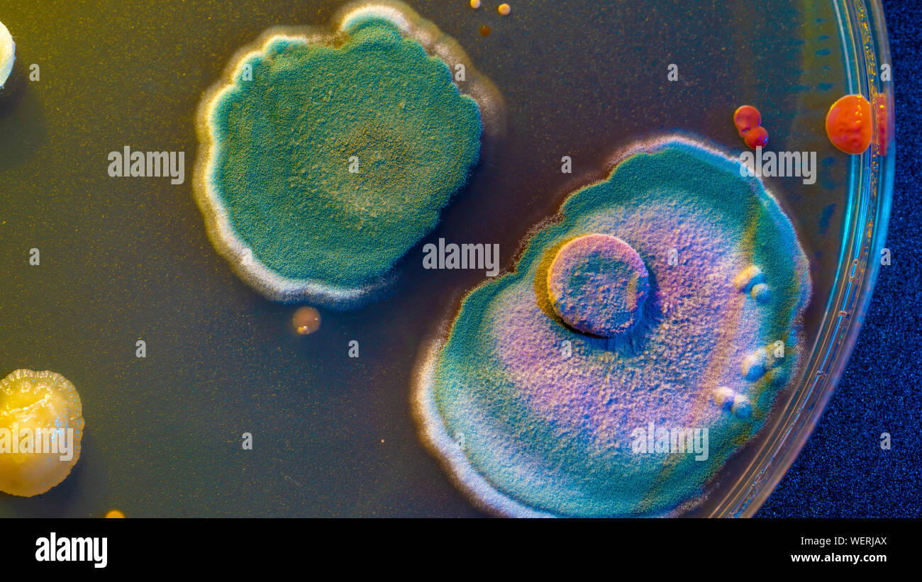 Microbial colonies on petri dish Stock Photo - Alamy