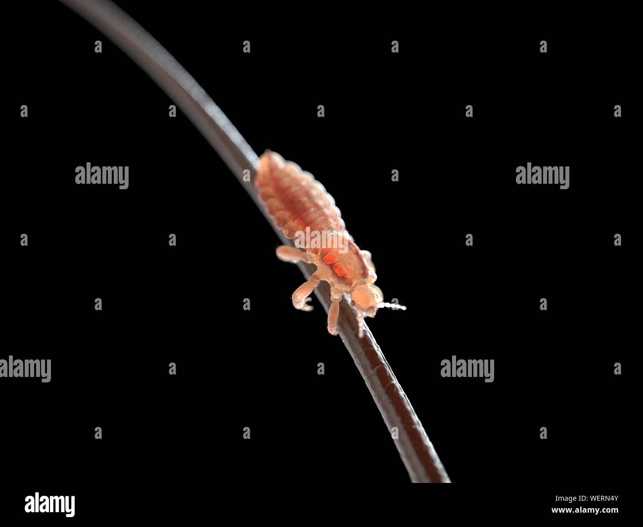 Head louse, illustration Stock Photo - Alamy
