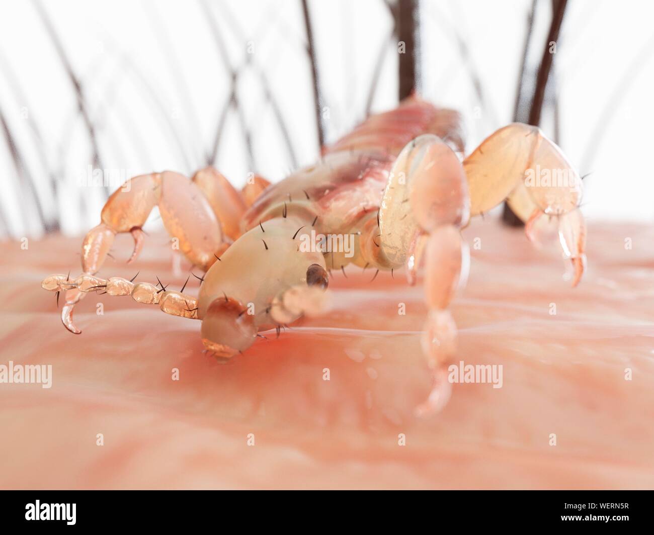 Head louse, illustration Stock Photo - Alamy