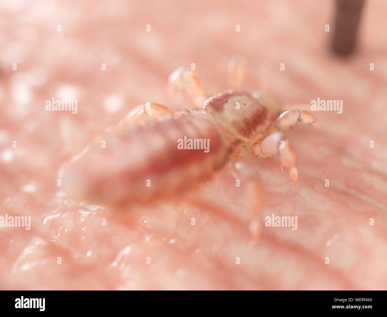 Human Louse High Resolution Stock Photography and Images - Alamy