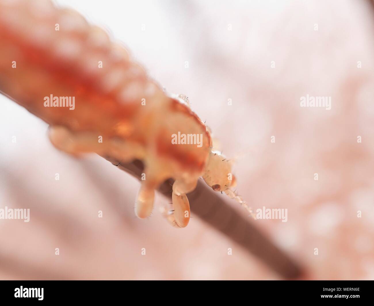Human louse hi-res stock photography and images - Alamy