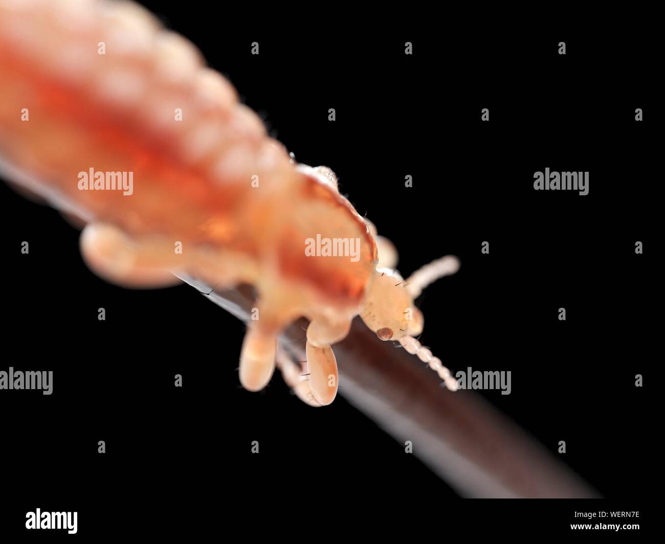 Human louse hi-res stock photography and images - Alamy