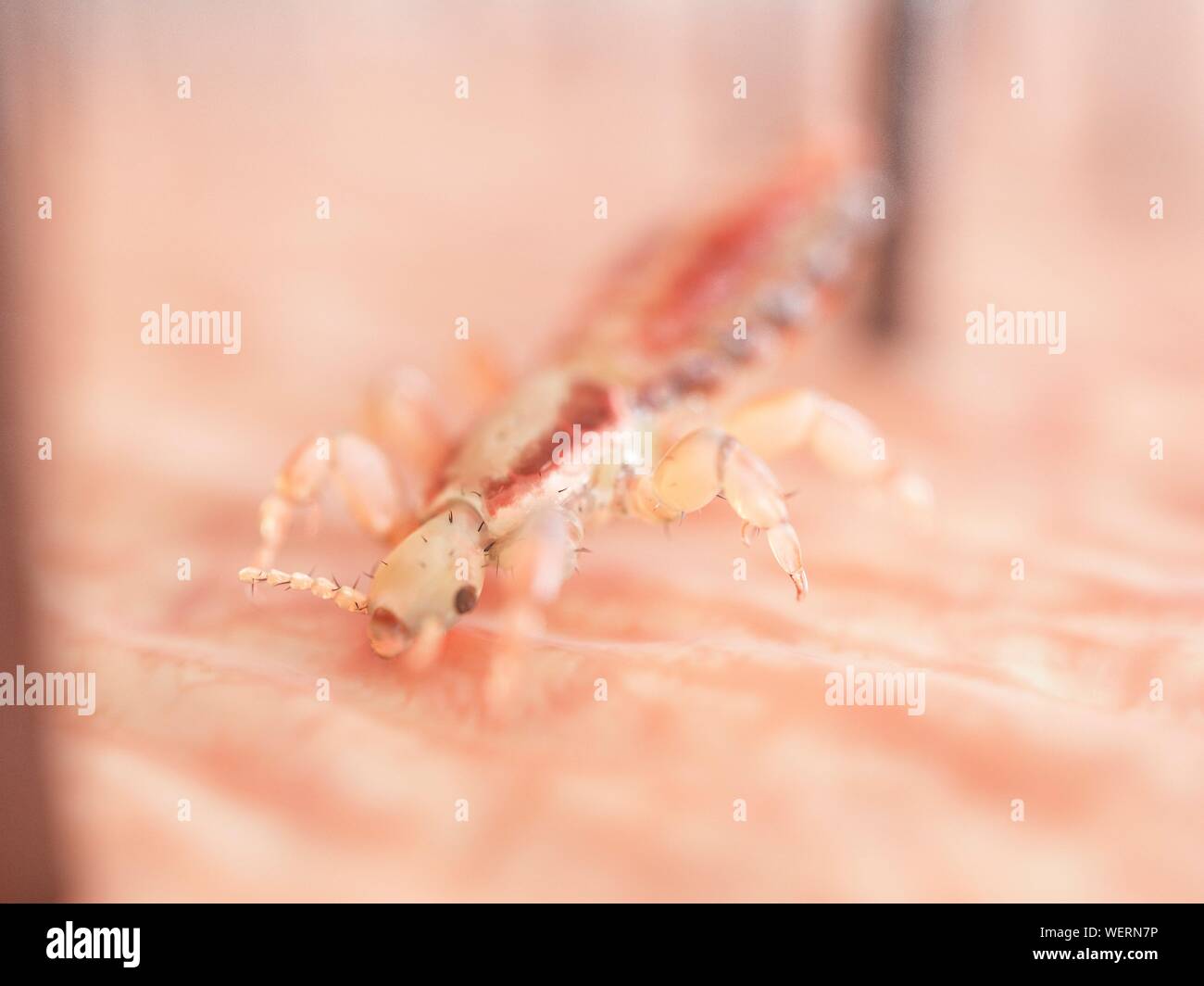 Head lice nymphs hi-res stock photography and images - Alamy