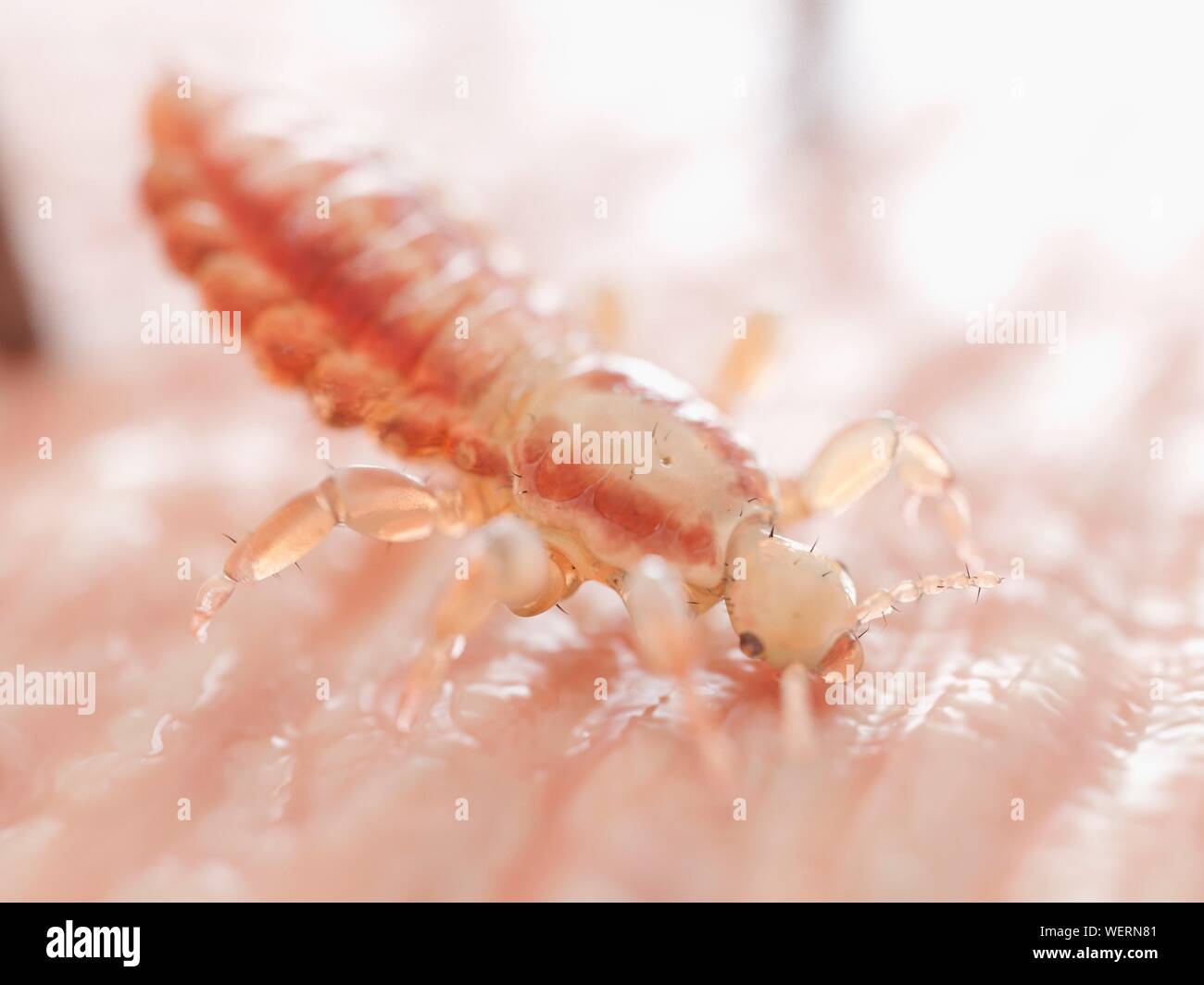 Head lice nymphs hi-res stock photography and images - Alamy