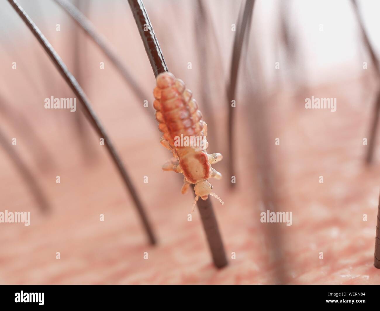 Head louse, illustration Stock Photo - Alamy